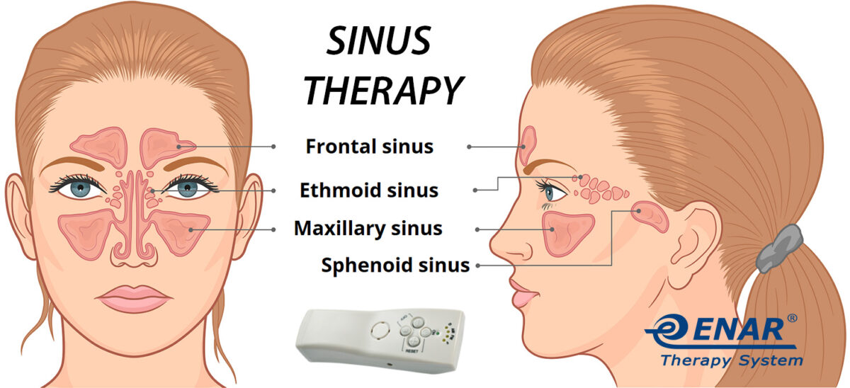 Sinusitis ENAR Therapy Use and Anatomy - ENAR Device & ENAR Therapy